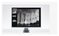 Digital Radiography | Anthony Scianni, D.M.D.