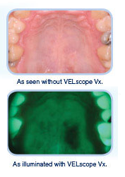 VELscope | Anthony Scianni, D.M.D.